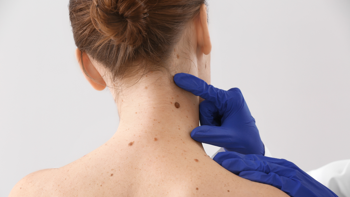 Hobart Skin Cancer Clinic | Home